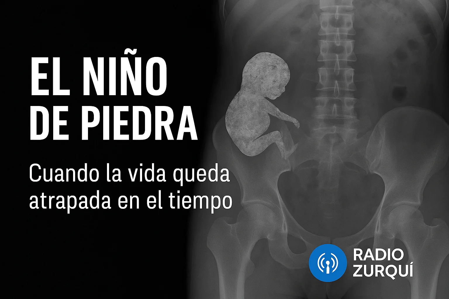 El niño de piedra: cuando la vida queda atrapada en el tiempo — Radio ...